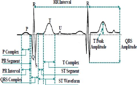 figure 1 from separation and classification of fetal ecg signal by