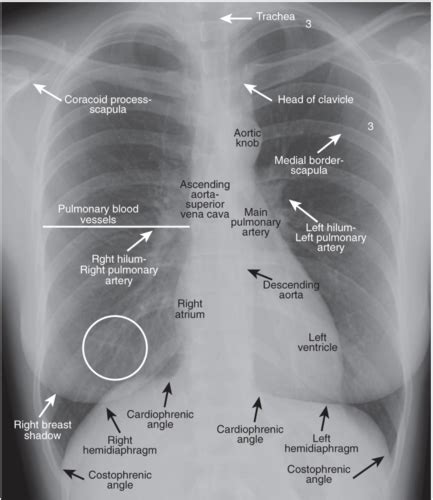 Radiology Chapter Flashcards Quizlet
