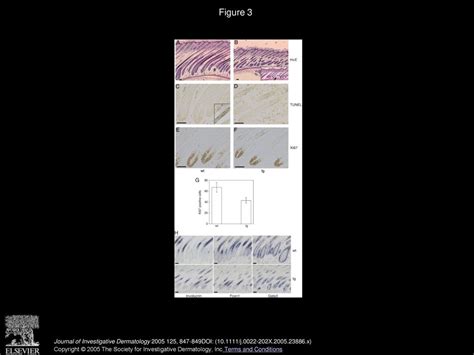 Igfbp3 Modulates Cell Proliferation In The Hair Follicle Ppt Download