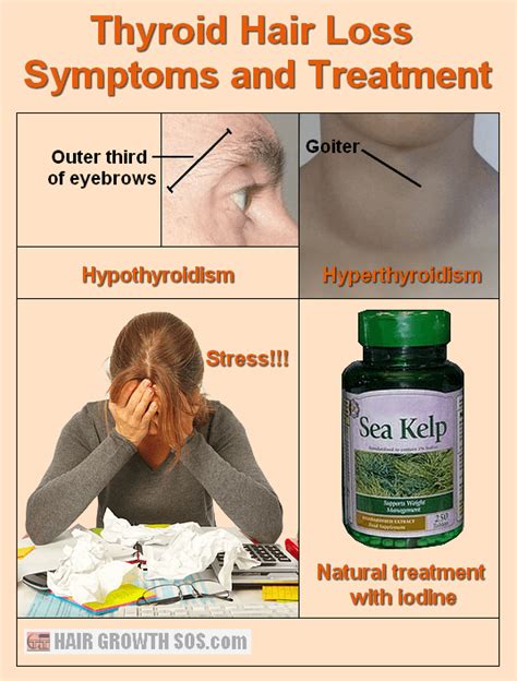 Thyroid Hair Loss Conditions Symptoms And Treatment Options