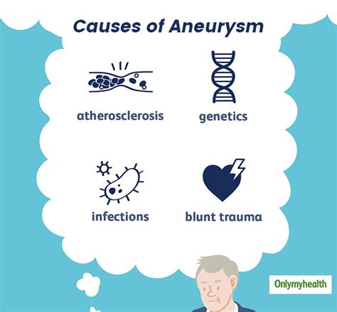 What Is Aneurysm Here Are Its Symptoms Causes Diagnosis And