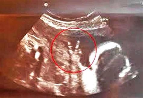 Abdullah Odeh Abdullahodeh4 Twitter