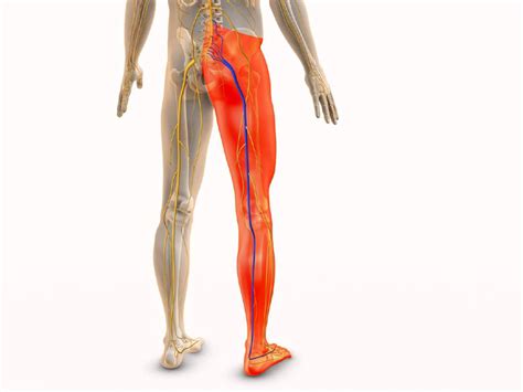 Fisioterapia Para La Ciática Técnicas Para Aliviar El Dolor