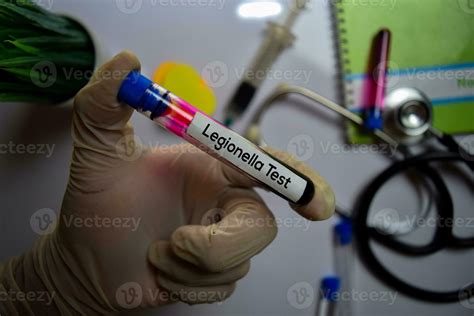Legionella Test Text With Blood Sample Top View Isolated On Black