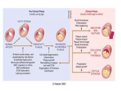 29 Atherosclerosisppt