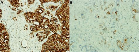 Expression Of Class Iii β Tubulin βiii Tubulin In Available Tissue Download Scientific