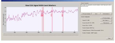 Signal Visualization And Annotation Screen From The Researcher Facing