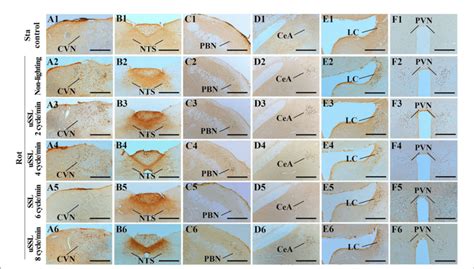 FIGURE Representative Photomicrographs Showing Fos Immunolabeling In