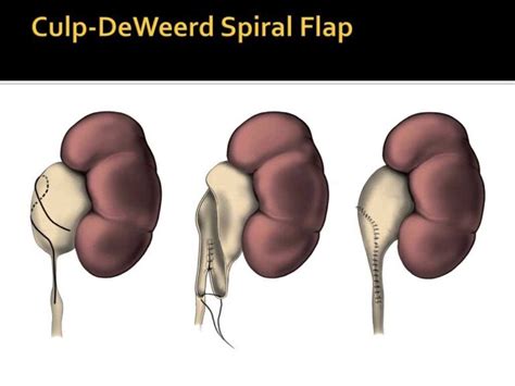 Prostate Cancer Prostate Cancer Screening Expert Treatment For Prostate Disorder