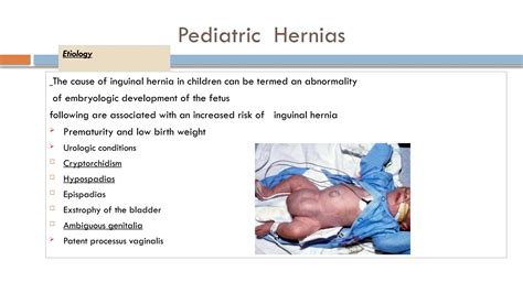 Pediatrics Hernias Common Types By Zmarpptx