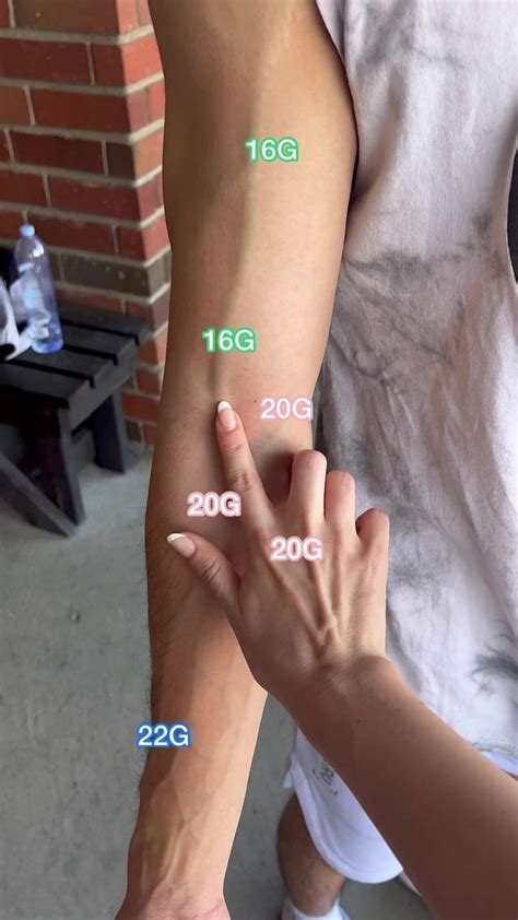 Peripheral Iv Access R Foamed911