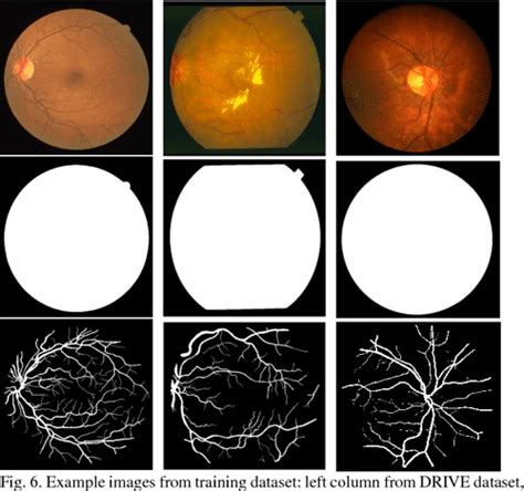 Pdf Recurrent Residual Convolutional Neural Network Based On U Net
