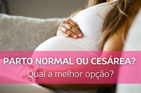 Parto Normal ou Cesárea Qual a melhor opção Mamãe Empoderada