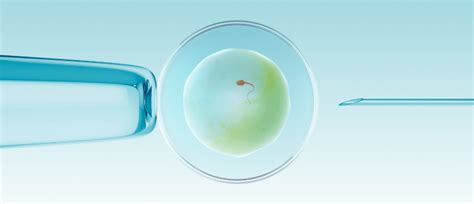 This New Noninvasive Method Can Better Predict Ivf Outcomes Fmai Hub