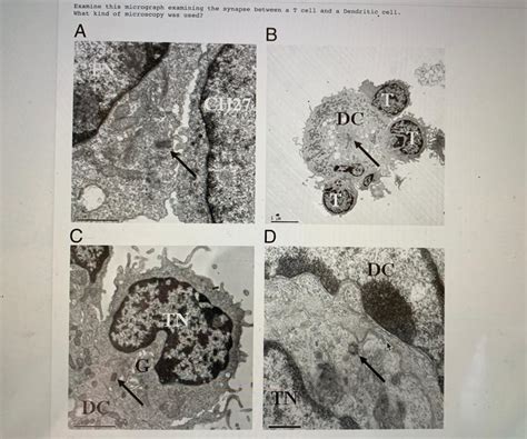 Solved Examine This Micrograph Examining The Synapse Between