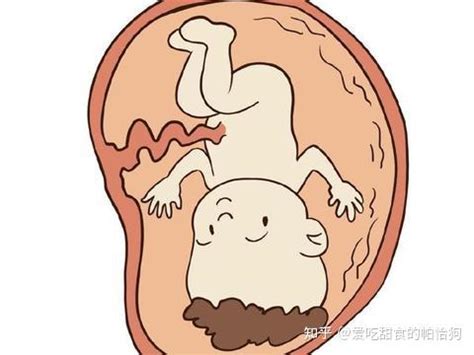 输卵管畸形难孕的女性想怀孕能去做试管婴儿吗 知乎