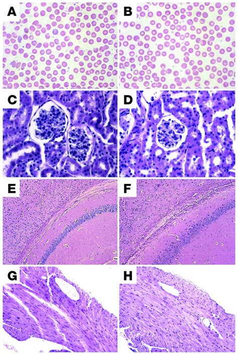 Jci Shigatoxin Triggers Thrombotic Thrombocytopenic Purpura In