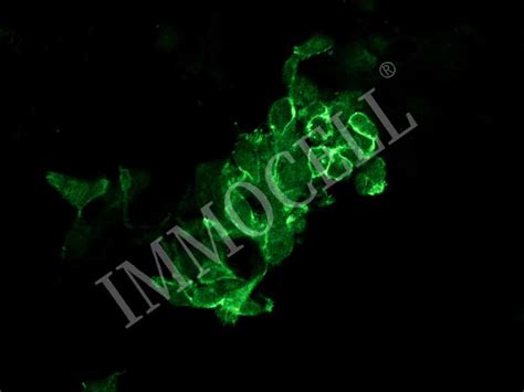 人视网膜微血管内皮细胞 逸漠细胞库