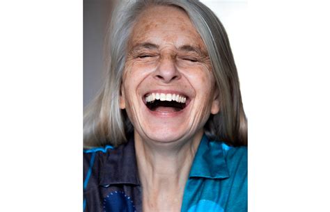 Hyperpigmentation And Menopause Menopause Blog Versalie™ Versalie™️