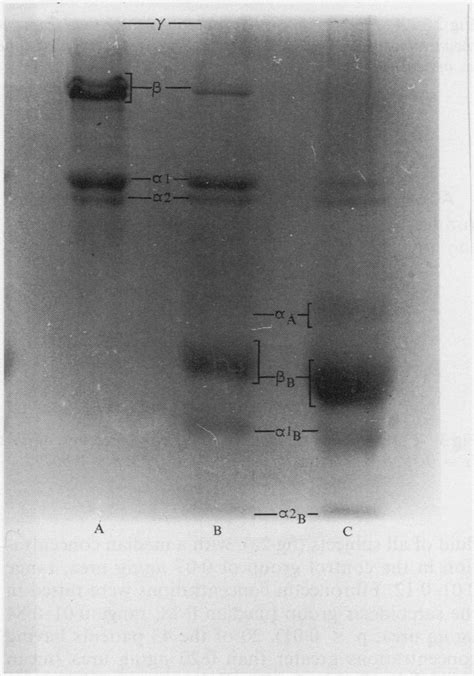 Sds Polyacrylamide Gel Electrophoresis Profiles Of A Native