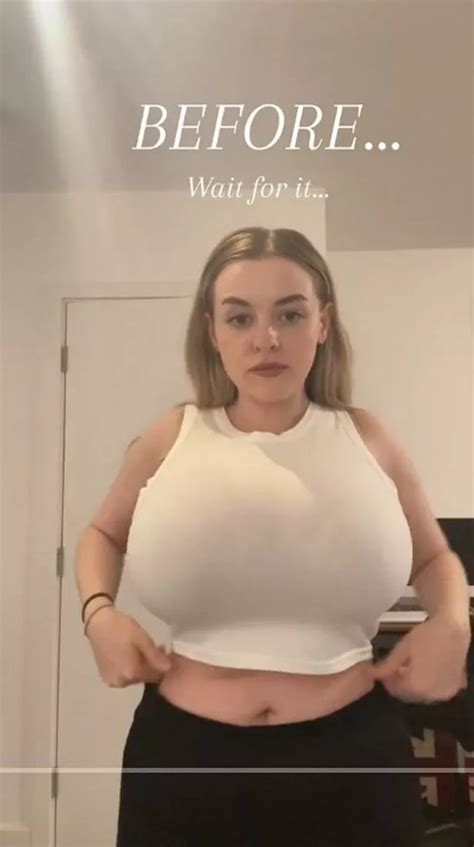 My Big Boobs Made Me Hunchback For Years But Im A Brand New Person