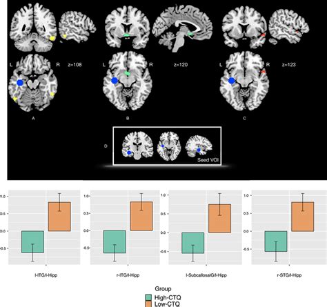 Functional Connectivity Ppi During Up P Tone Blocks Regions