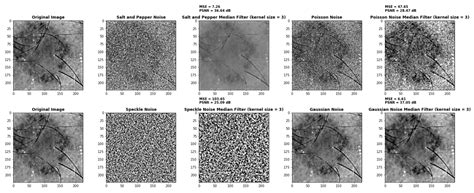 Skin Lesion Synthesis And Classification Using An Improved Dcgan Classifier