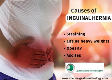 Gastroenterology Chennai On Linkedin Causes Of Inguinal Hernia Visit
