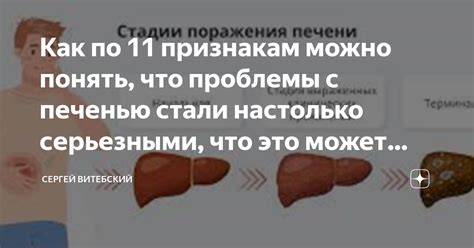 Как по 11 признакам можно понять что проблемы с печенью стали настолько серьезными что это