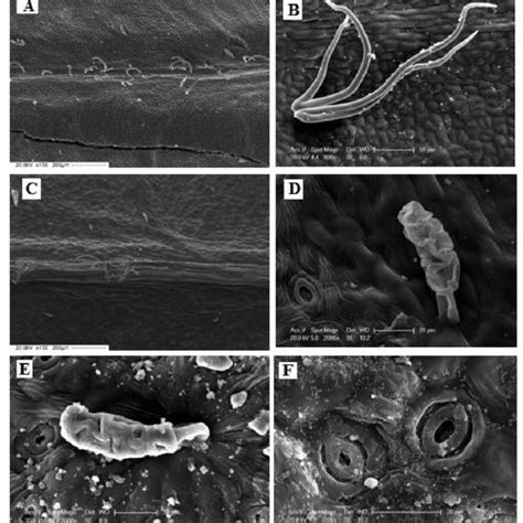 Scanning Electronmicrographs Of Wax And Different Types Of Trichomes On