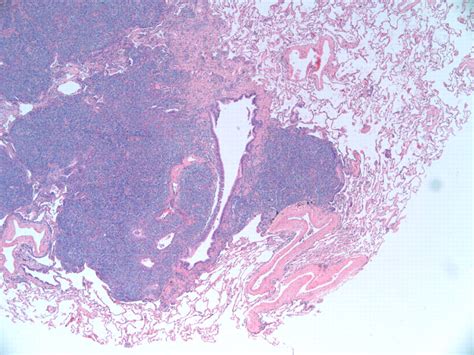 Gut Associated Lymphoid Tissue Histology