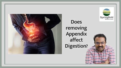 Springfield Wellness Centre On Linkedin Appendix Appendicitis