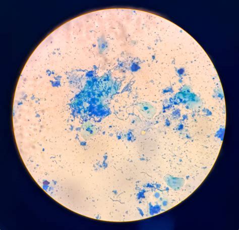 60 Enterococcus Faecium Foto Foto Stok Potret And Gambar Bebas Royalti