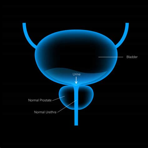 160 Prostate Hypertrophy Stock Illustrations Royalty Free Vector