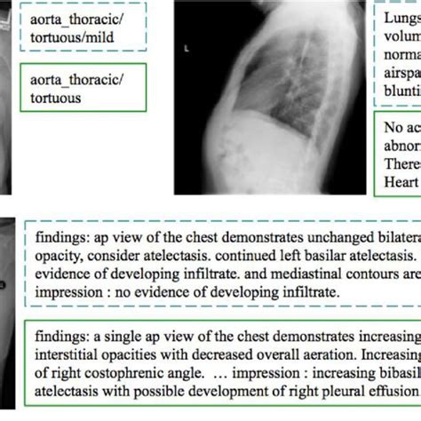 Top Row Left Text Annotation Produced By The Model In 18 Top Row