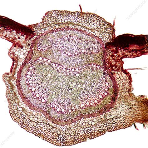 Beech Tree Leaf Light Micrograph Stock Image C0115233 Science