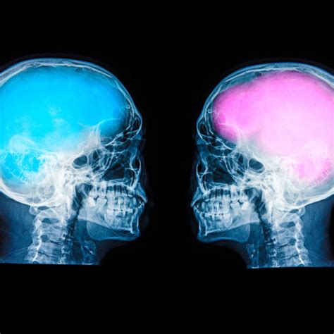 Theres No Such Thing As A Male Or Female Brain Study Finds