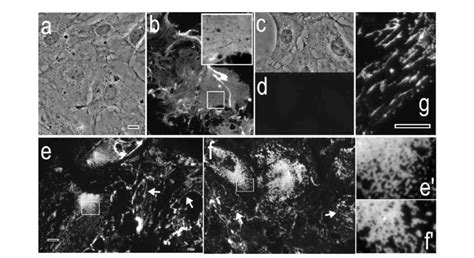 Laminins Assemble Into Two Distinct Extracellular Matrices On Schwann