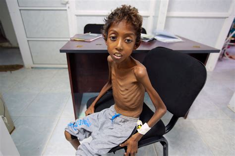 Lonu Met En Garde Contre Le Risque De Famine Dans Quatre Pays