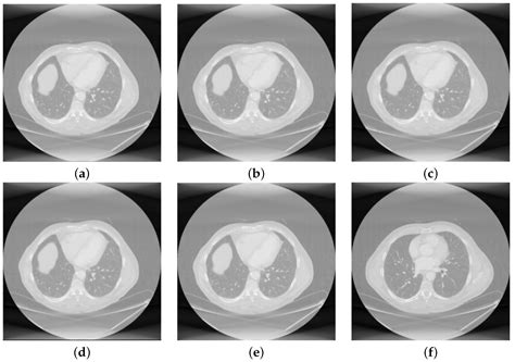 a novel geometric parameter self calibration method for portable cbct