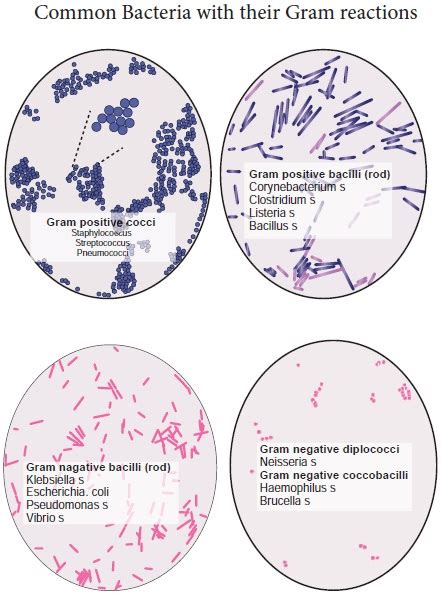 Special Staining Endospore Staining