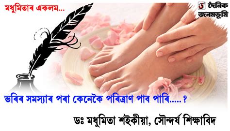 বাৰিষাকালত ভৰিৰ সমস্যাৰ পৰা কেনেকৈ পৰিত্ৰাণ পাব পাৰি