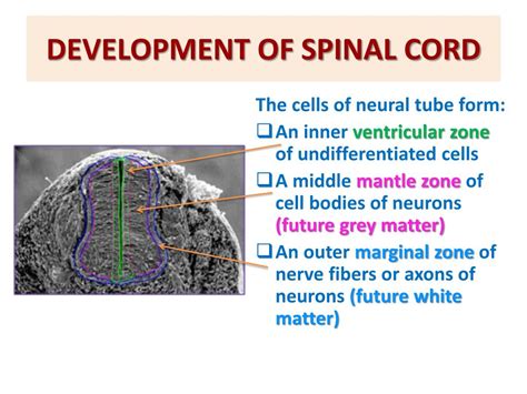 Ppt Development Of Vertebral Column And Spinal Cord Powerpoint