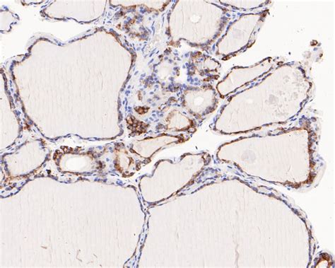 Thyroid Peroxidasetpo Recombinant Rabbit Monoclonal Antibody Je60 40