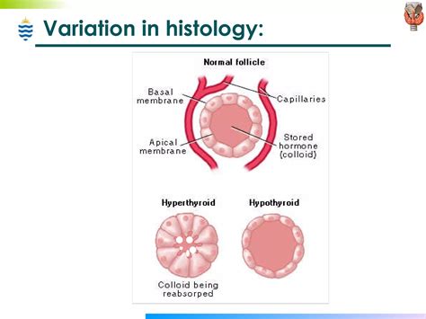 Pathology Of Thyroid And Endocrine Disorders Ppt