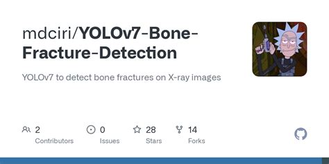 Yolov7 Bone Fracture Detectionyolov7datayaml At Main · Mdciriyolov7