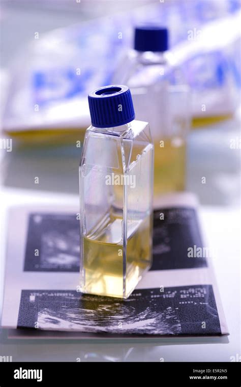 Amniotic Fluid Sample