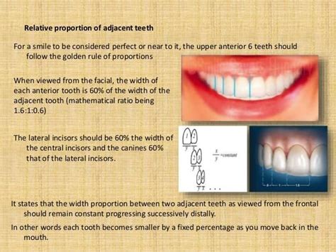Golden Proportion The Dentist Implants Veneers Emergency Center