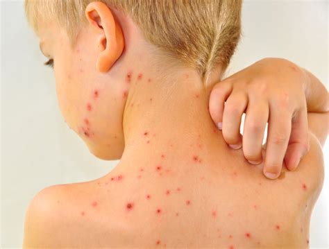 Evidencias En Pediatria Toma De Decisiones Clínicas Basadas En