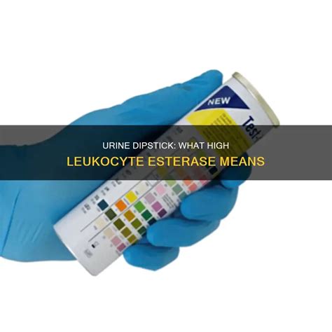 Urine Dipstick What High Leukocyte Esterase Means Medshun